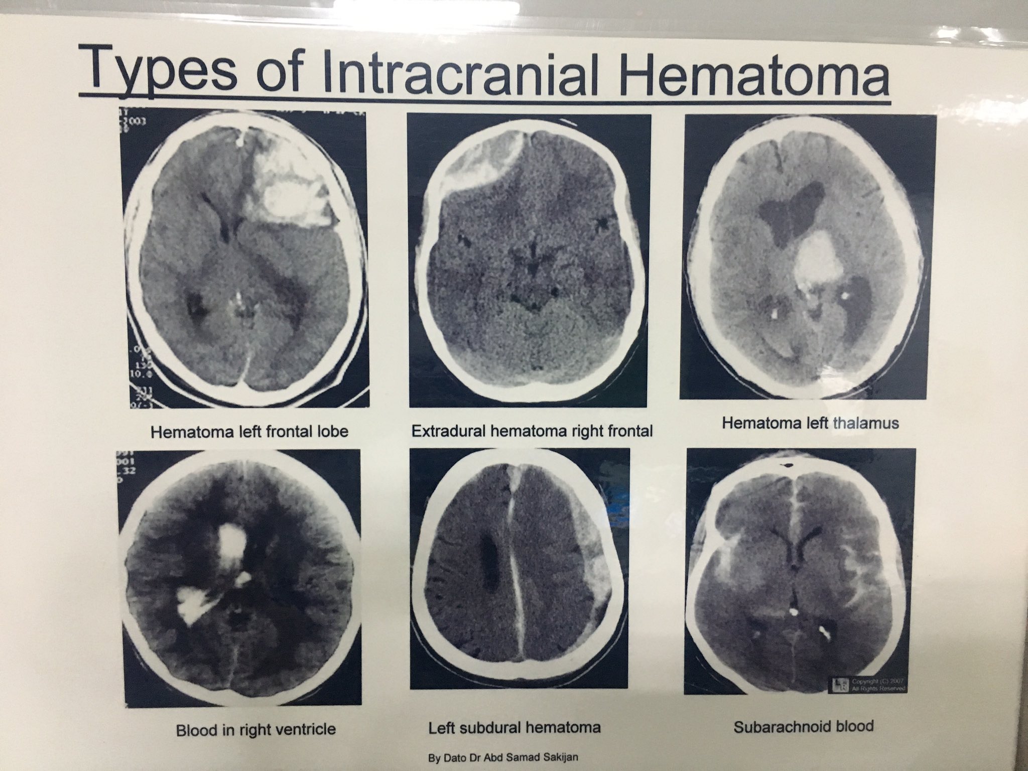 Different Types Of Scans