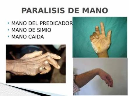 Quiroscopía forense | Detective Privado en Criminalística