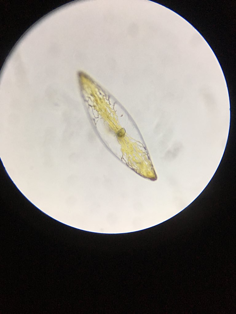Pyrocystis Fusiformis