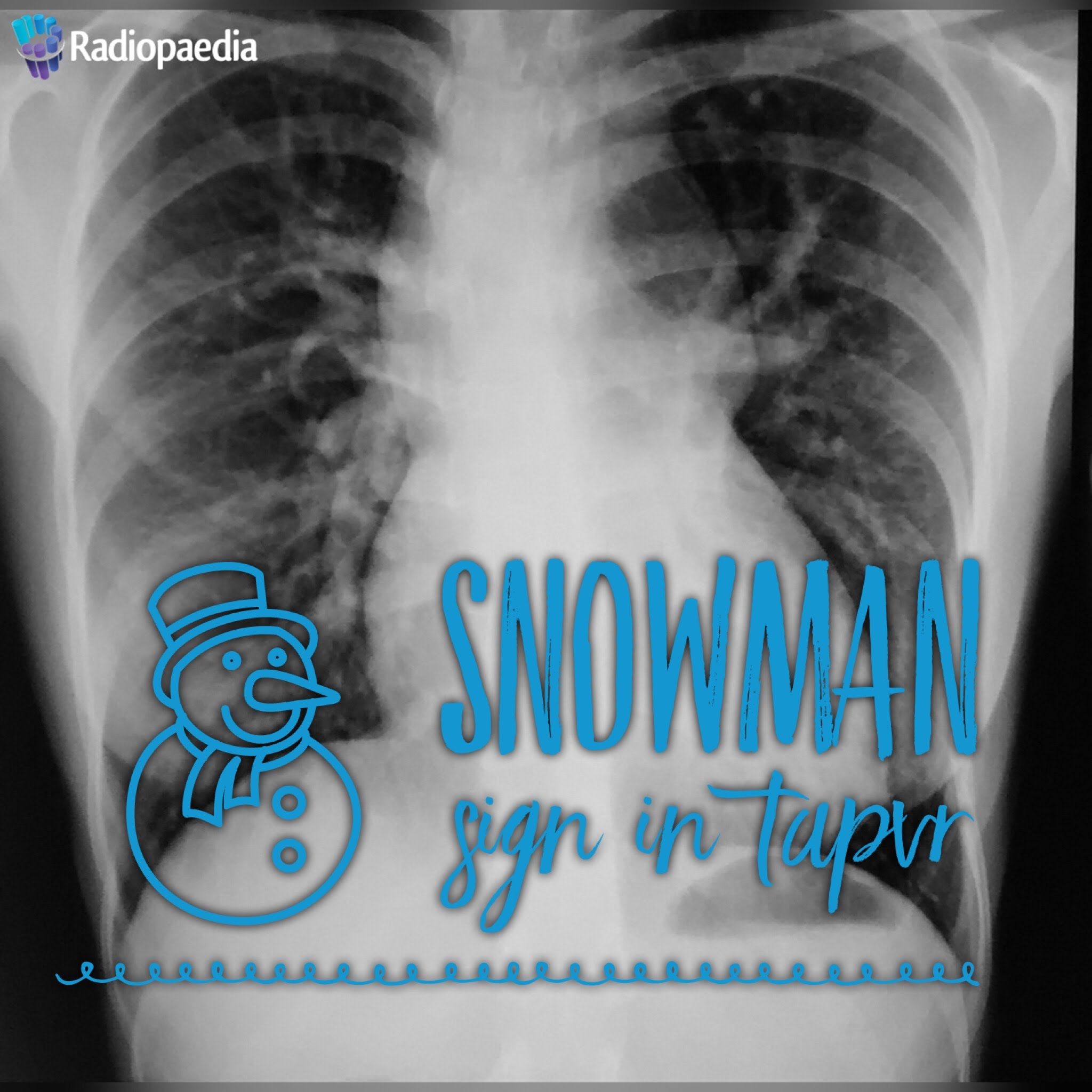 Tapvr Snowman Sign In