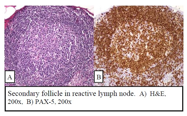 Secondary Follicle Lymph Node