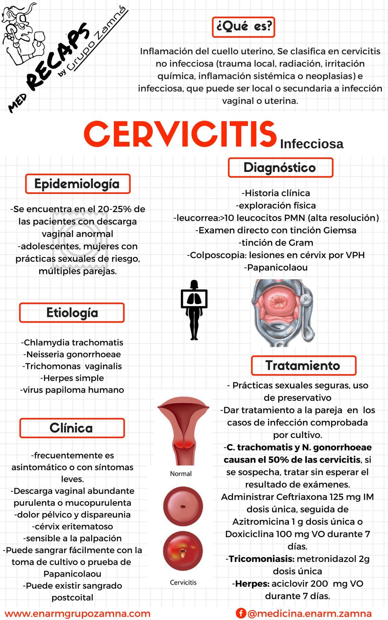 Cervicitis