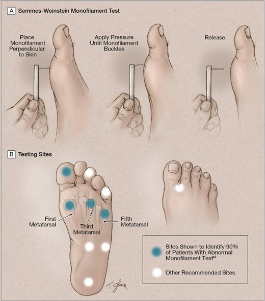 Diabetic Foot Exam