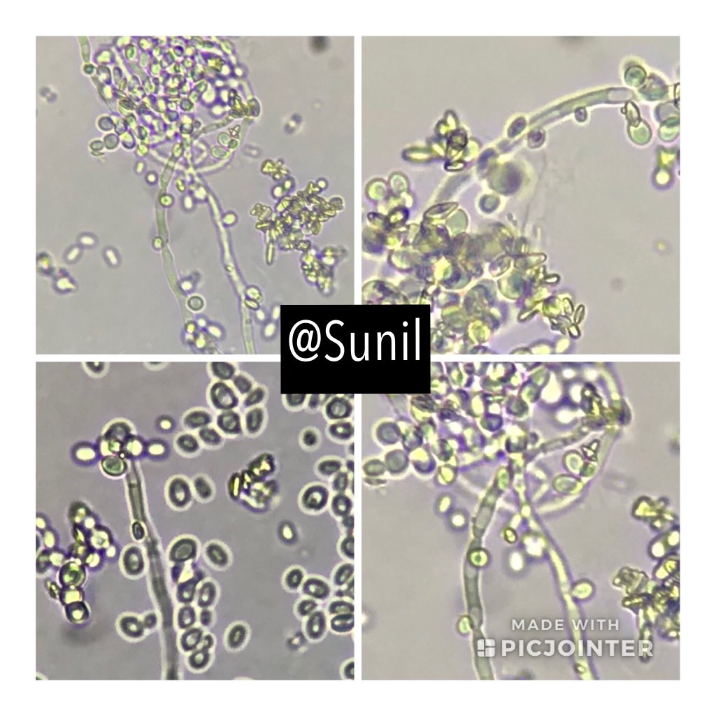 Candida In Urine