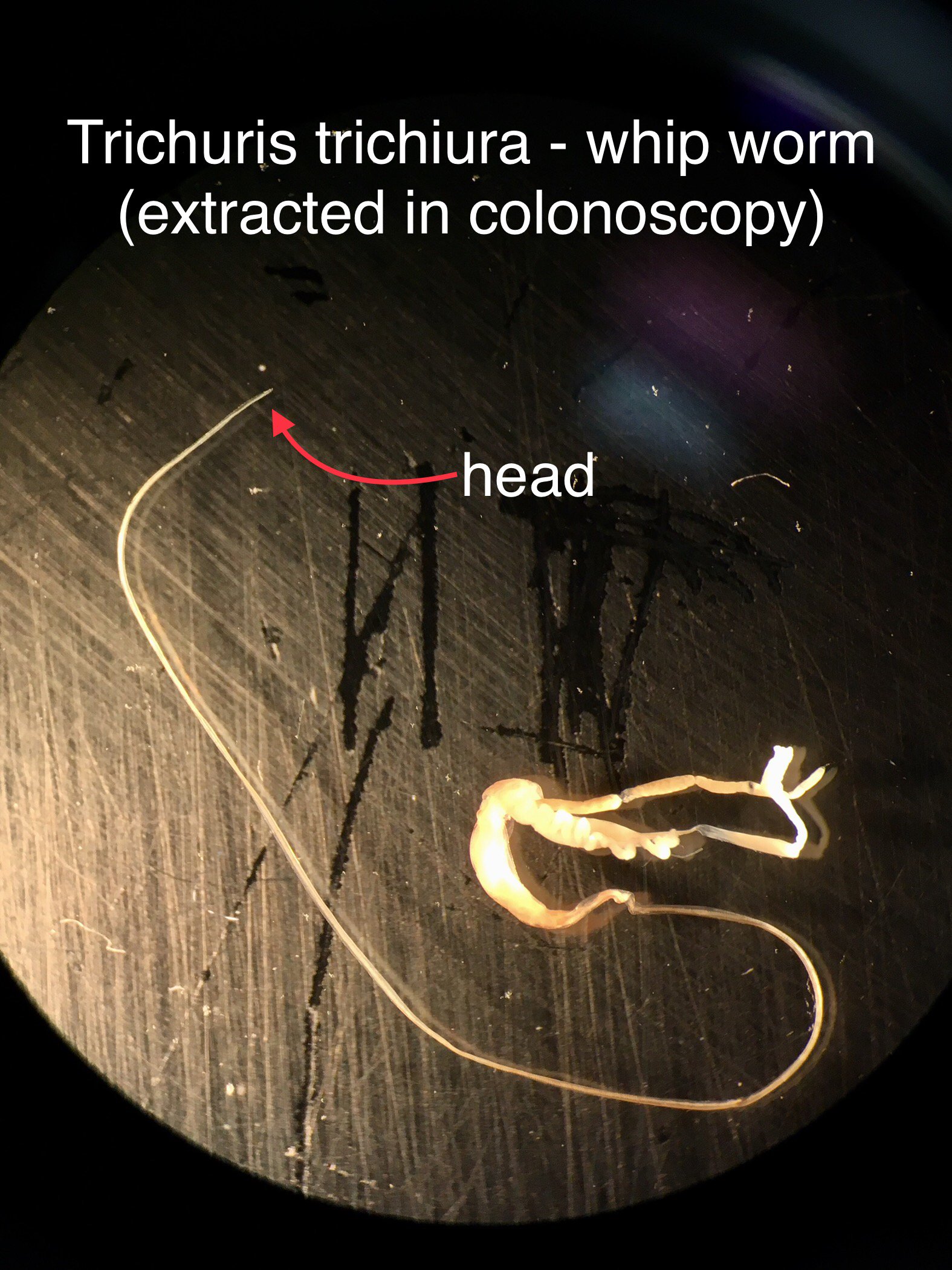 Trichuris Trichiura Worm
