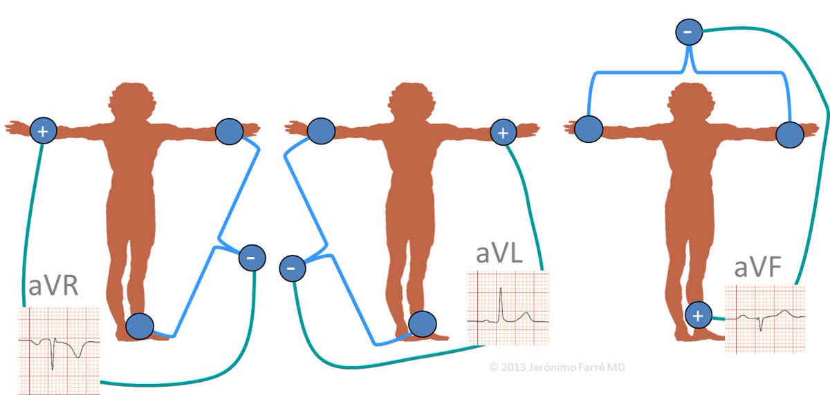 Electrocardiograma - Mind Map