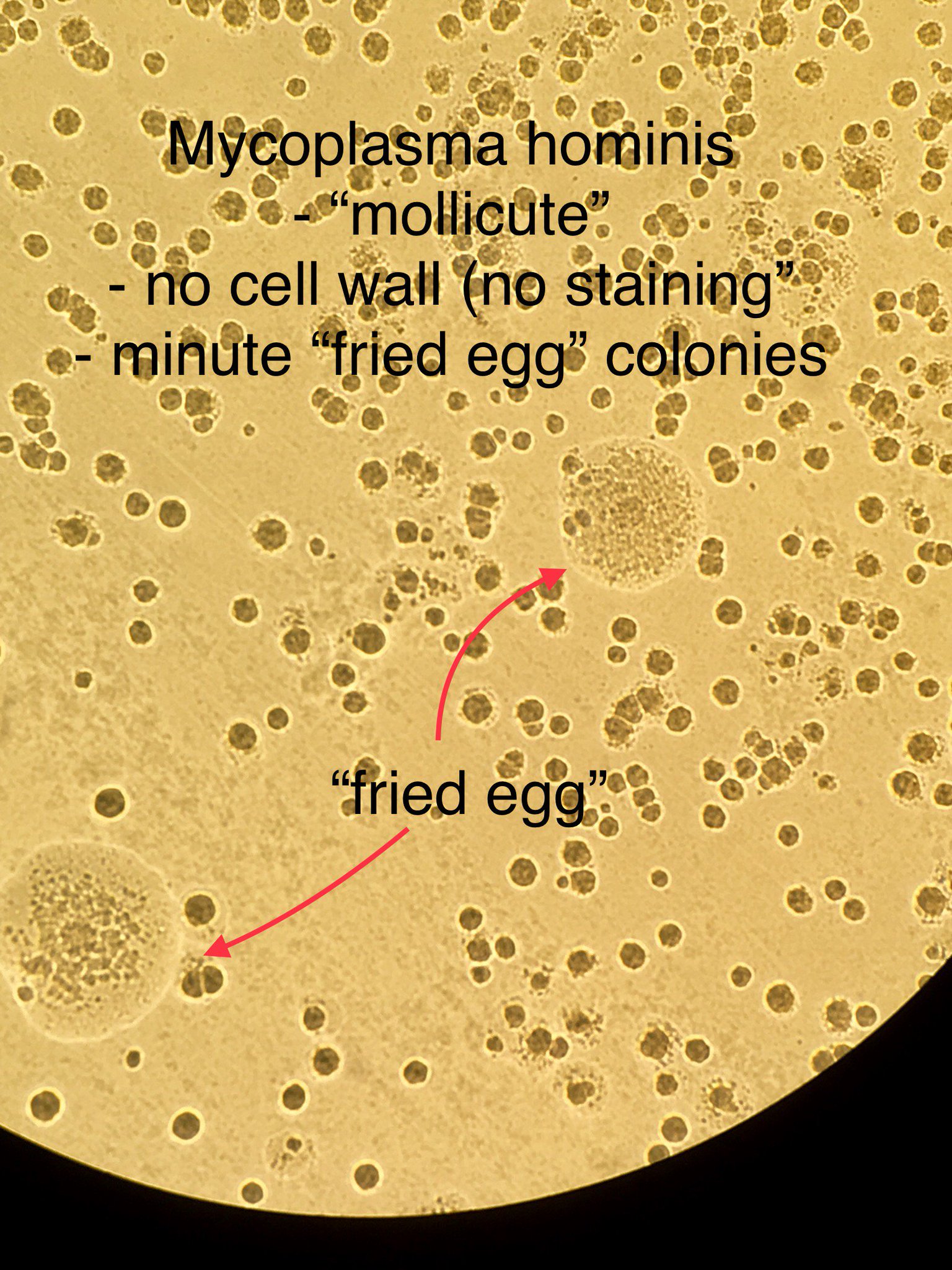 Mycoplasma Gram Stain