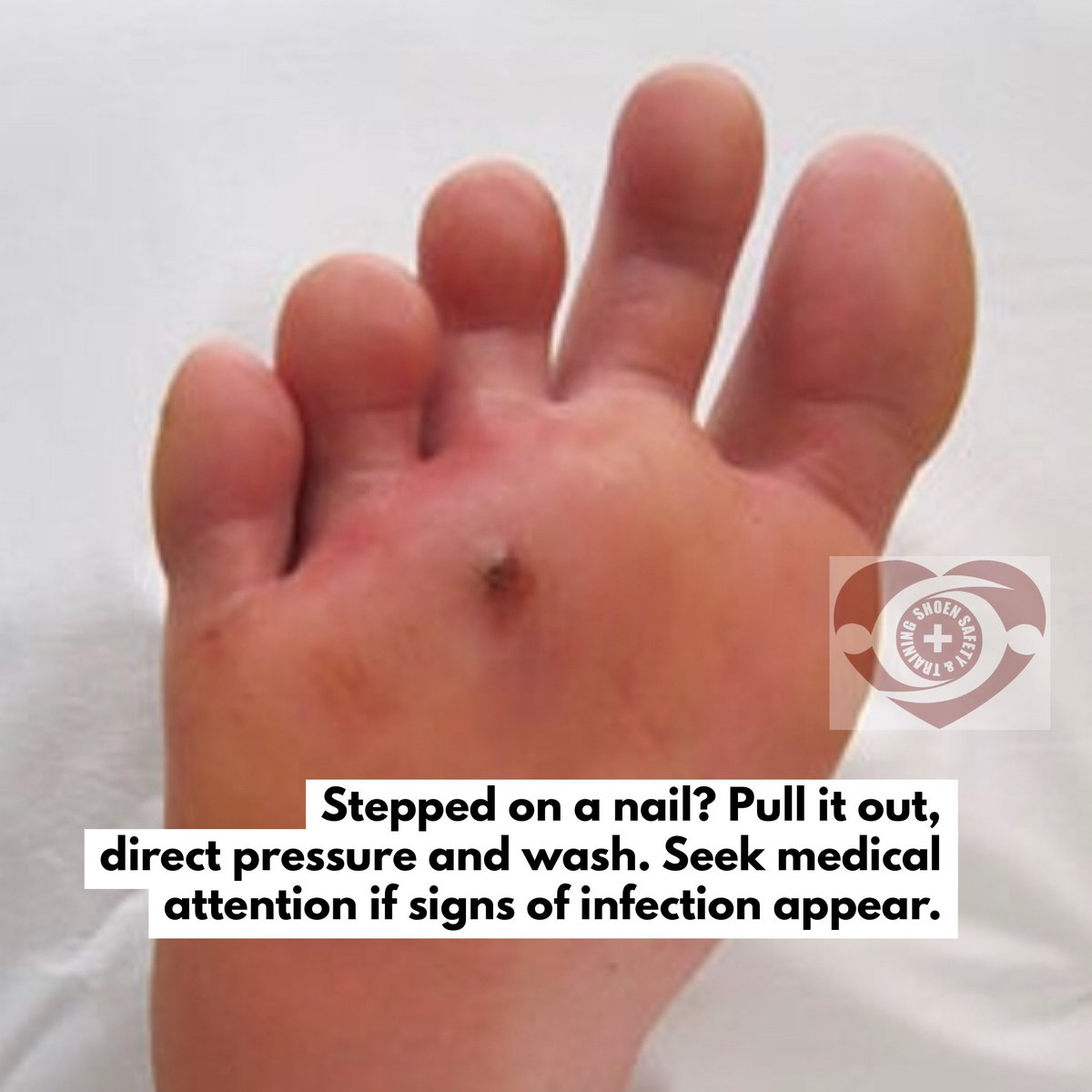 Puncture Wound First Aid