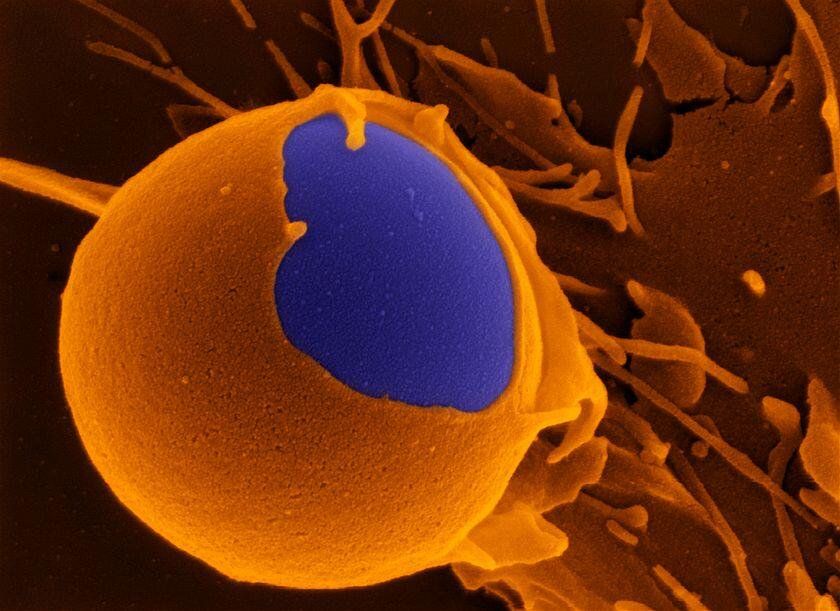 #science #art: #macrophage attacks foreign bodies under an electron # ...