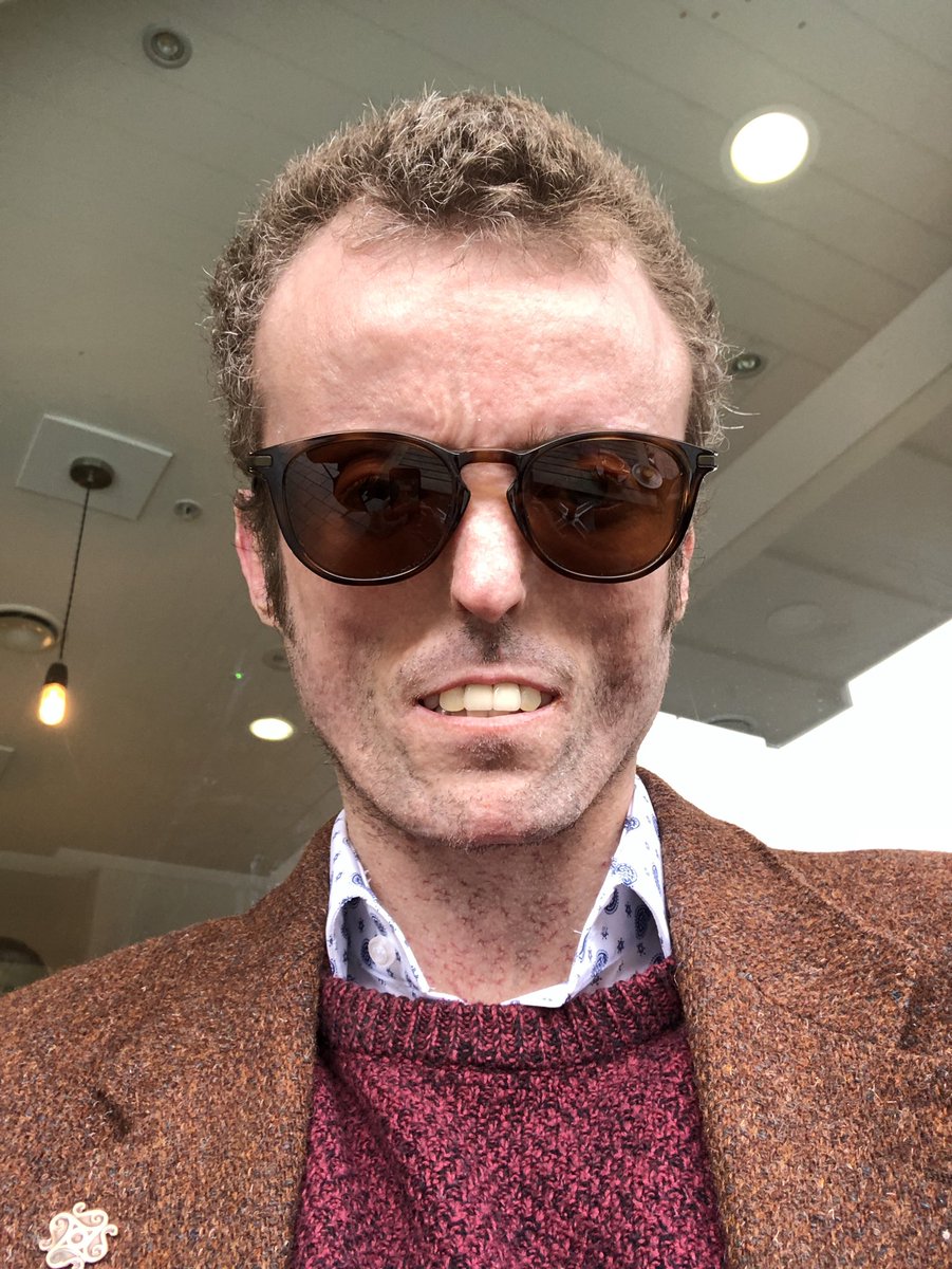 Tom Staniford Before