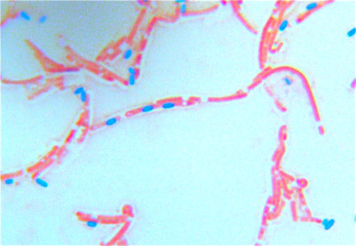 Bacillus Cereus Gram Stain