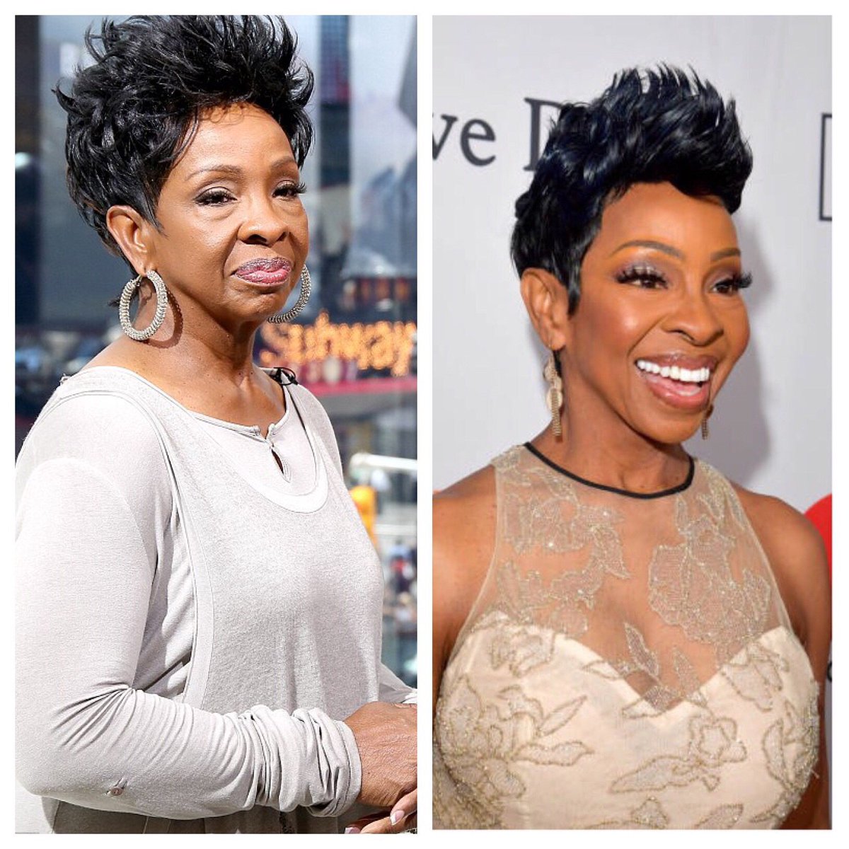 Gladys Knight Shuts Down Facelift Rumors— “I have good genes & eat ...