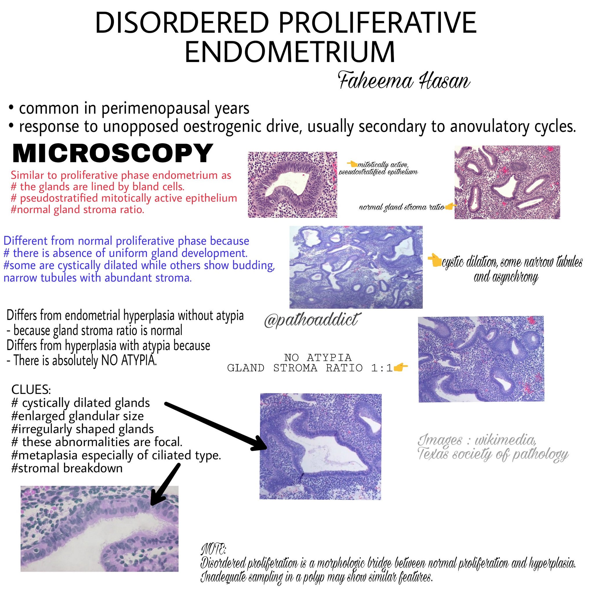 Proliferative Endometrium Histology