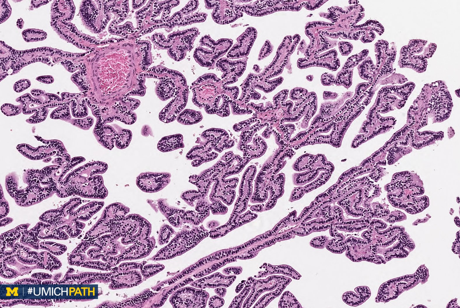Choroid Plexus Histology