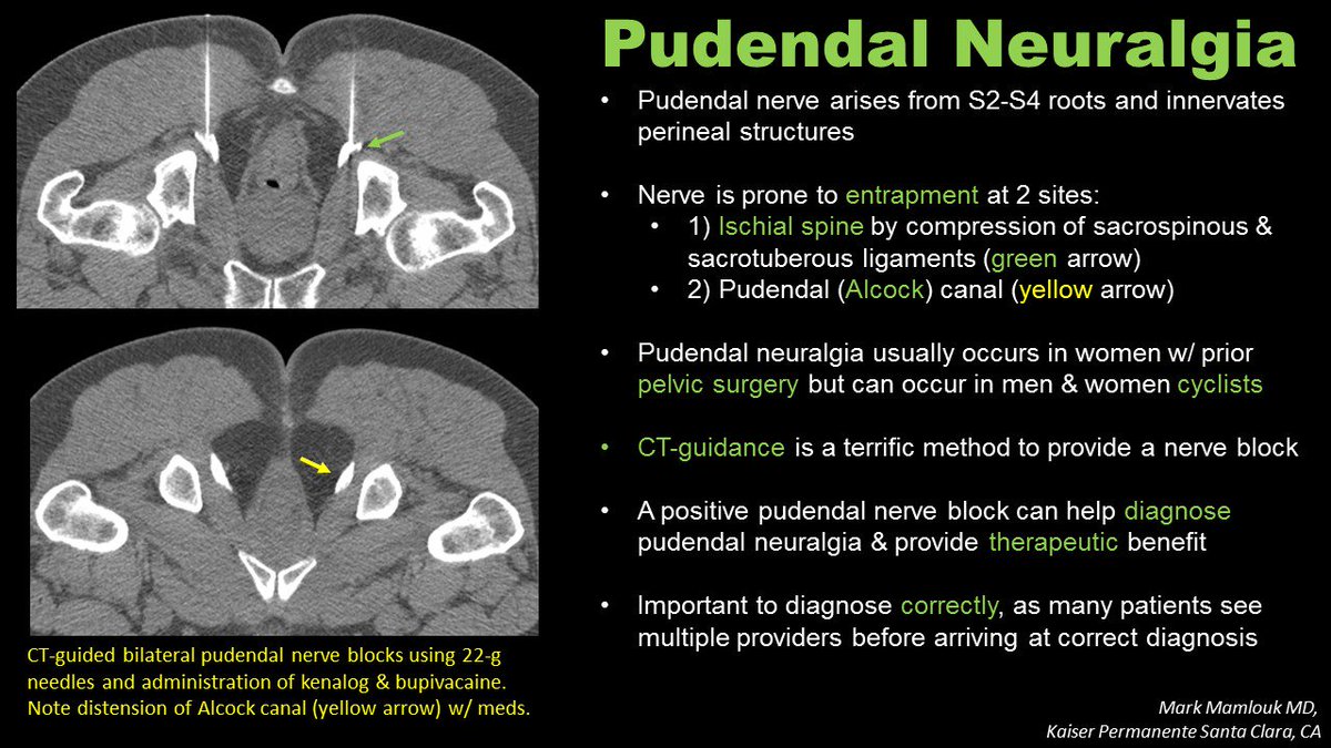 Pudendal Nerve