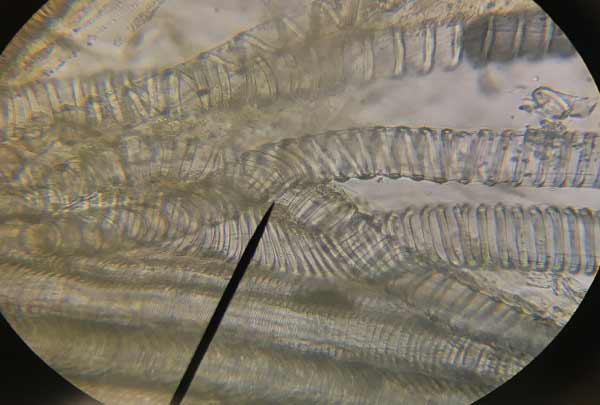 Xylem Tissue Under Microscope