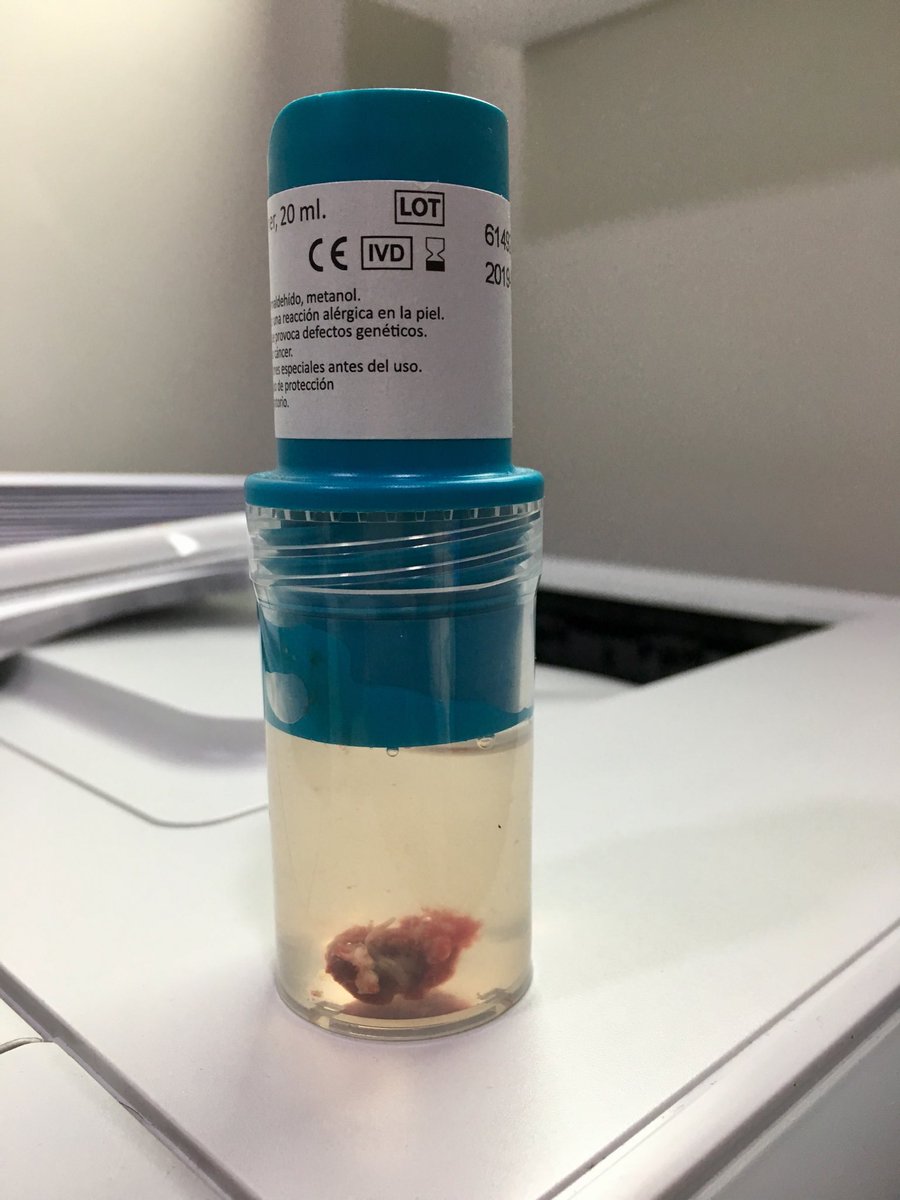 El Uso Del FORMOL En La Clinica Diaria Diagnóstico, 45% OFF