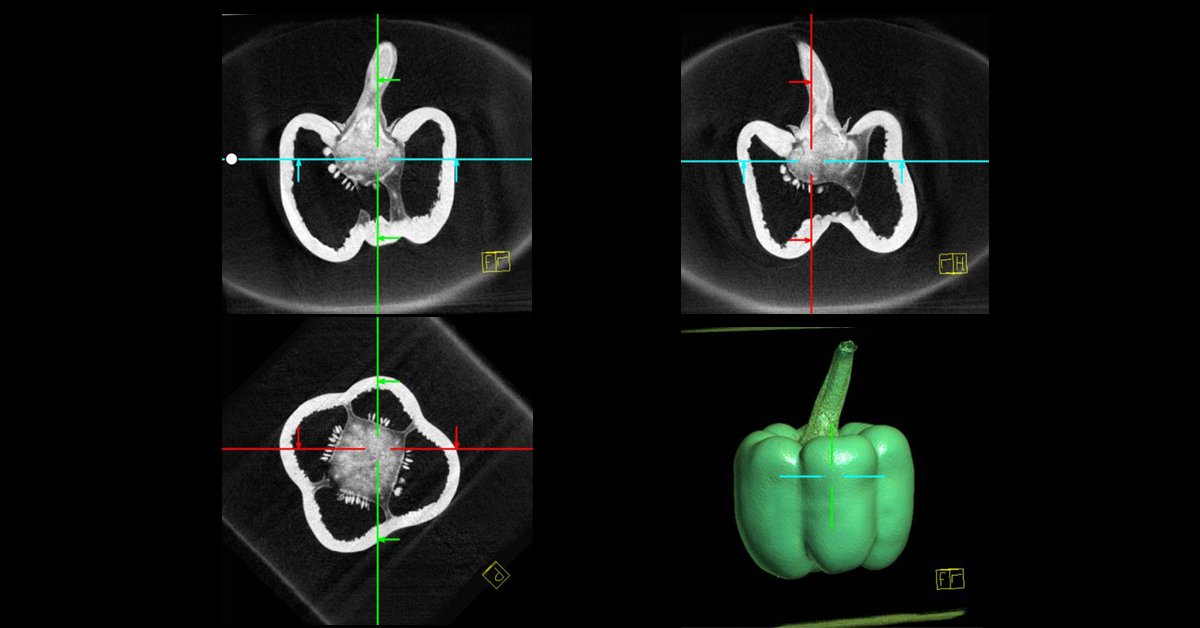 Intraoperative 3D imaging gives you all the views you need – even in a ...