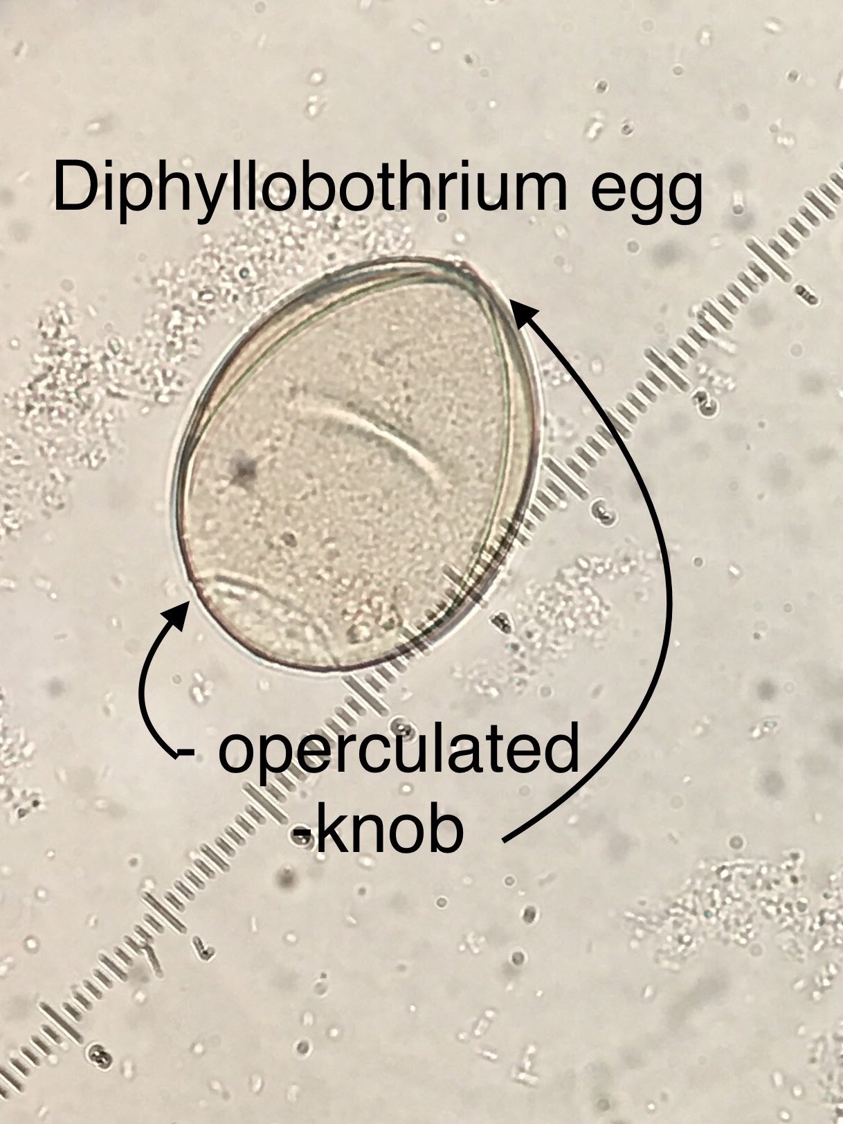 Diphyllobothrium Latum Proglottid
