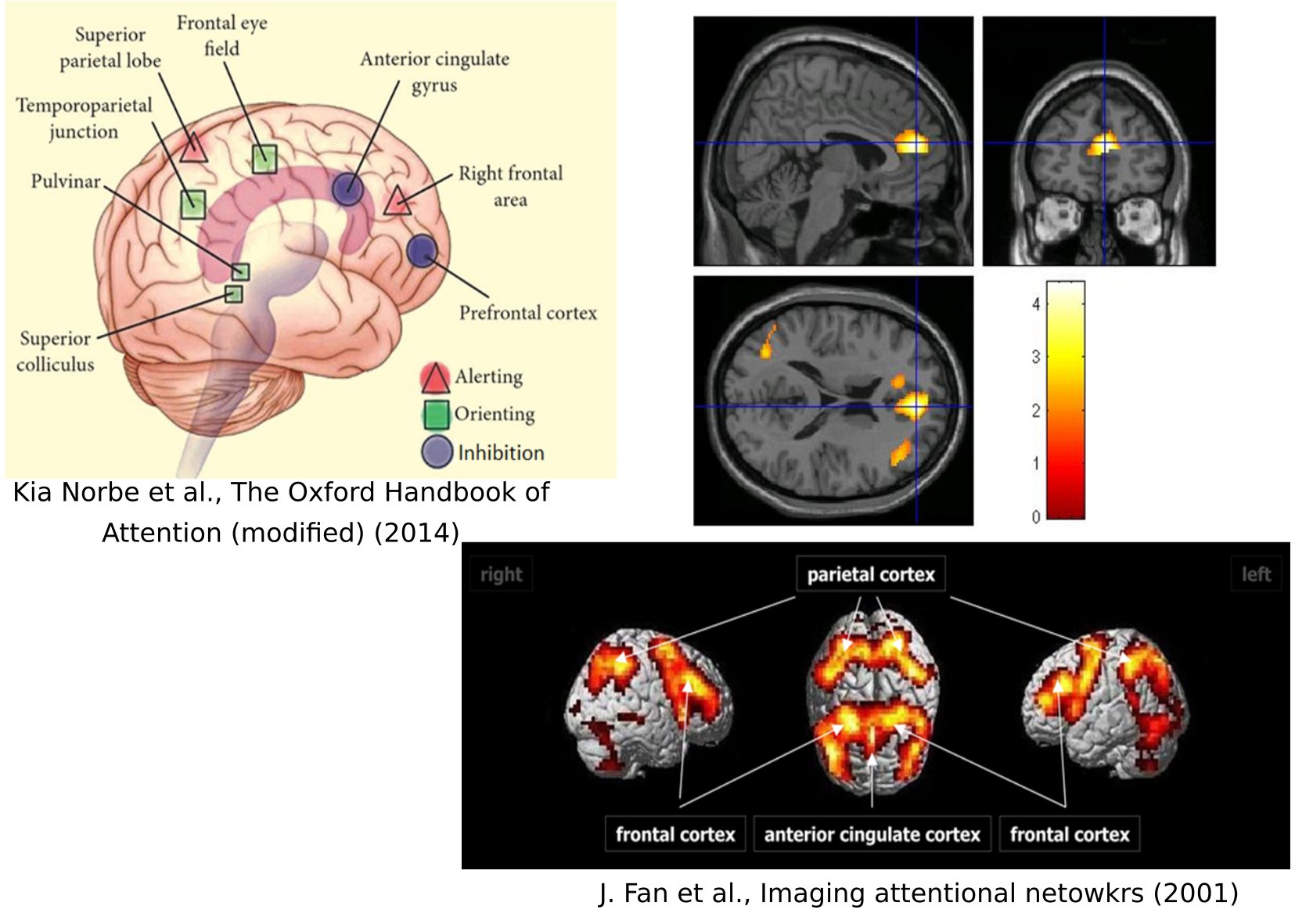 Attention Brain Networks