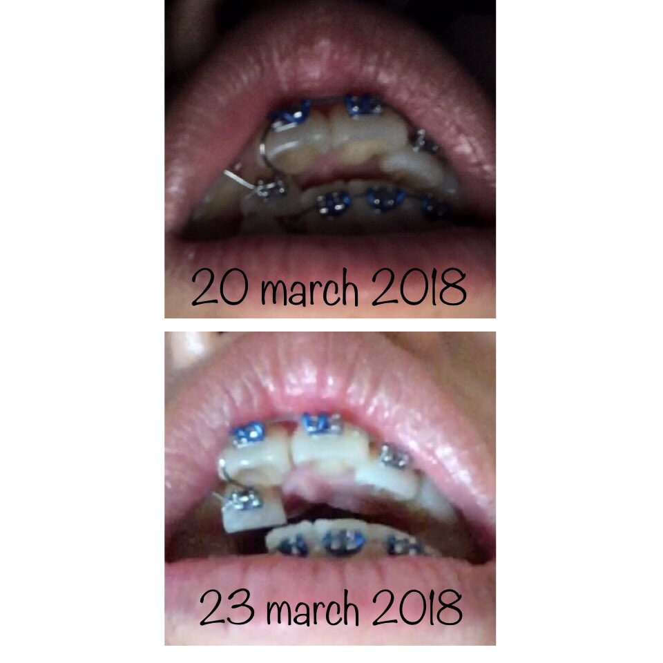 PATCHAREEPORN. 👑 (@mint_ps10) | Twitter