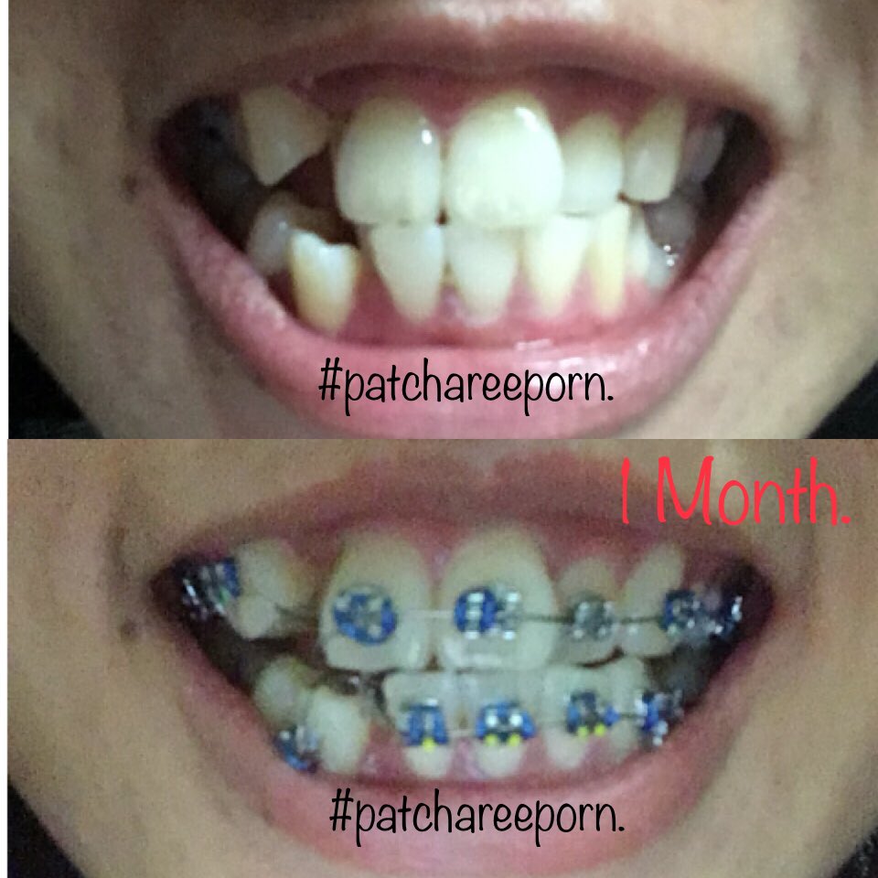 PATCHAREEPORN. 👑 (@mint_ps10) | Twitter