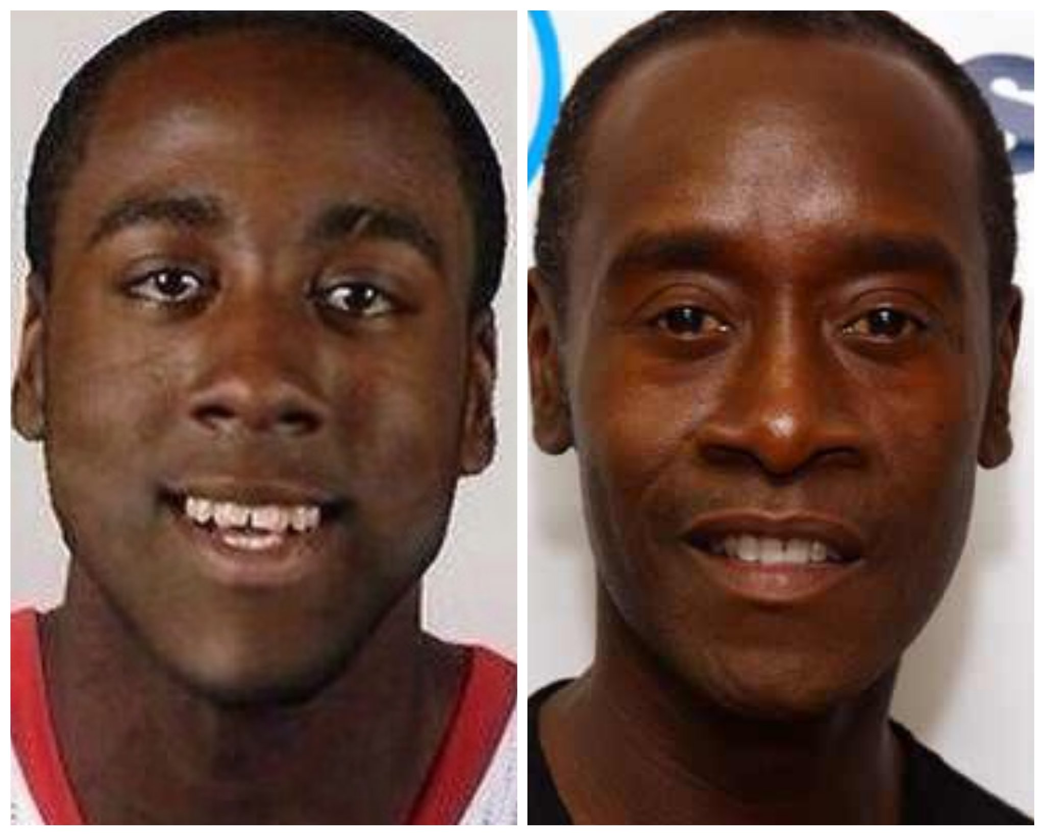 James Harden Teeth Fixed