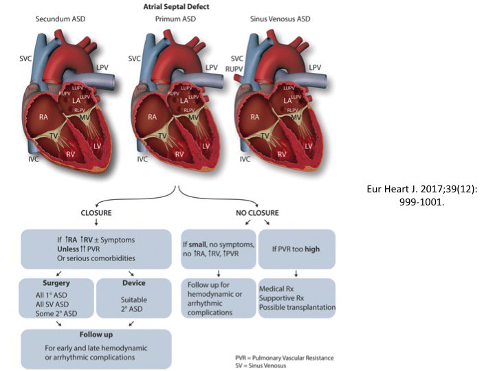 Atrial Septal Defect Types