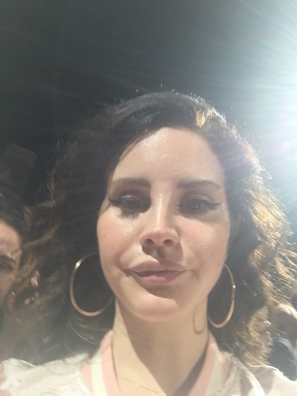 Lana Del Rey Botox Before And After