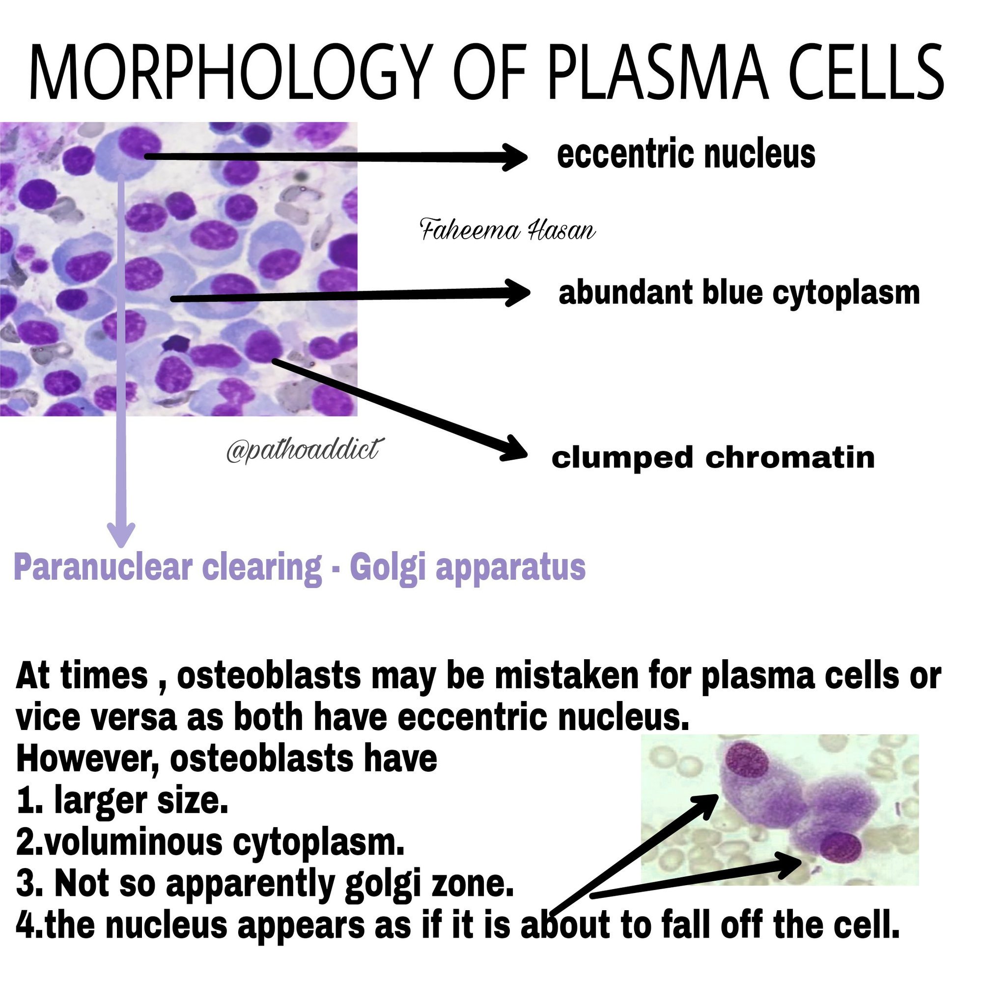 Plasma Cells