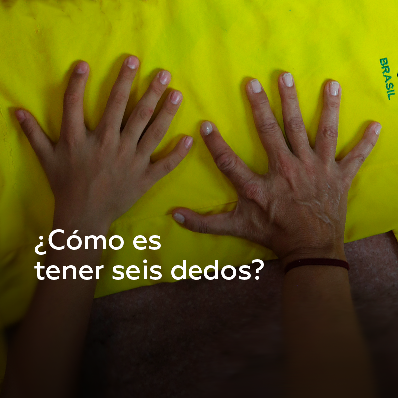 Las personas con seis dedos muestran las sorprendentes ventajas de ...