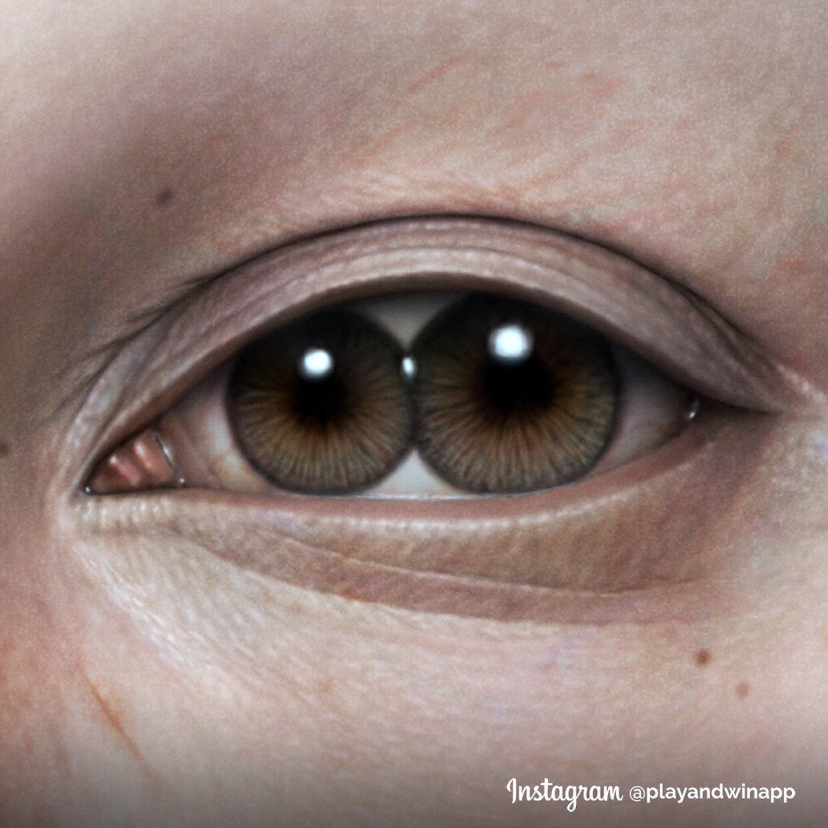 People With Two Pupils In One Eye