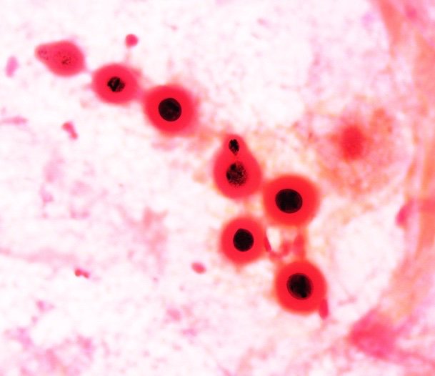 Cryptococcus Gram Stain