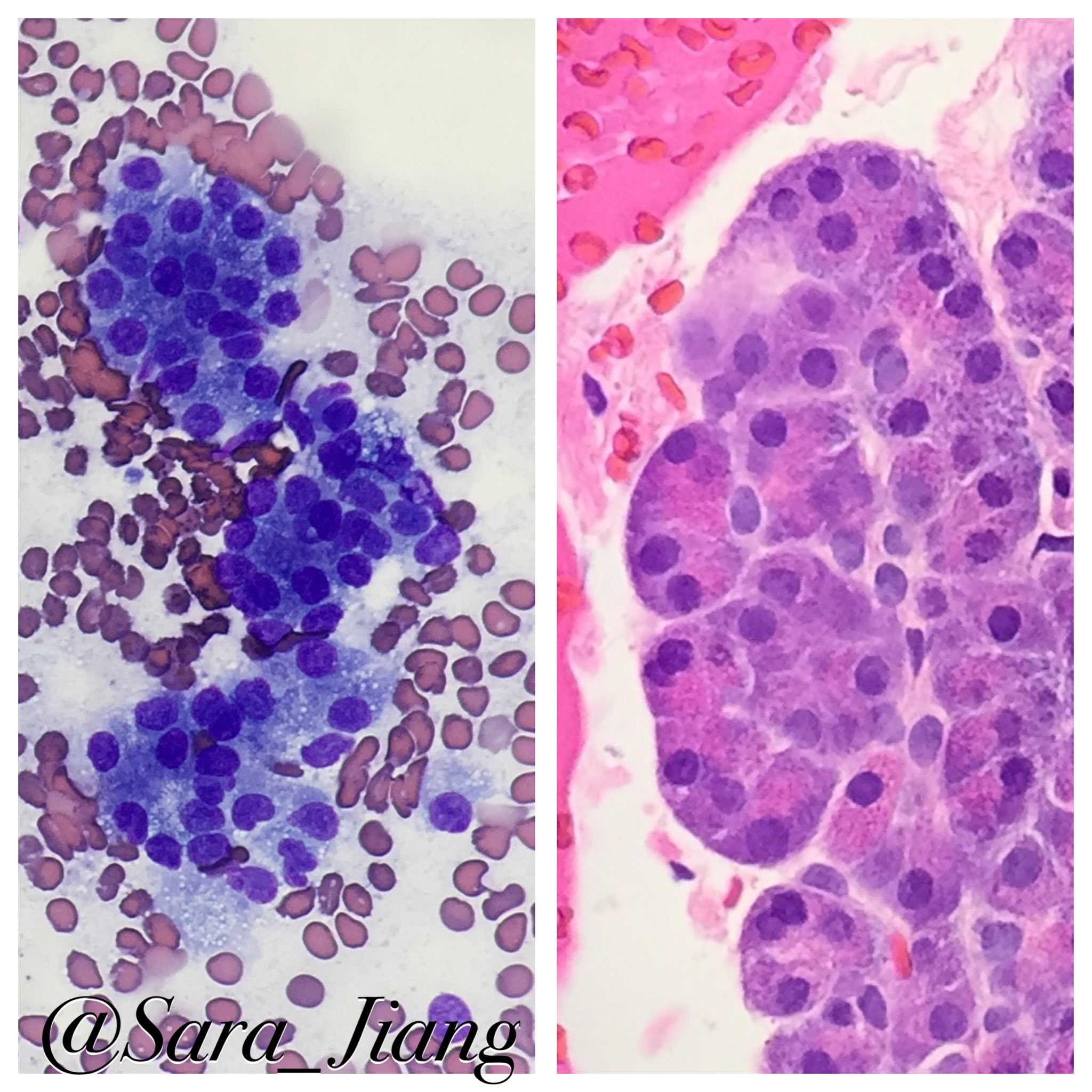 Acinar Cells Cytology
