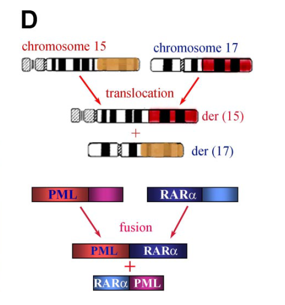 급성 전골수성 백혈병 (AML M3, acute promyelocytic leukmia= APL) : 네이버 블로그