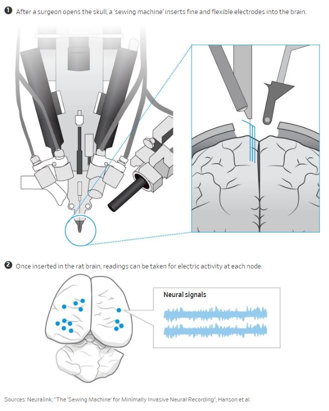 Neuralink: Elon Musk’s Neuralink shows off a device, implantable in a ...