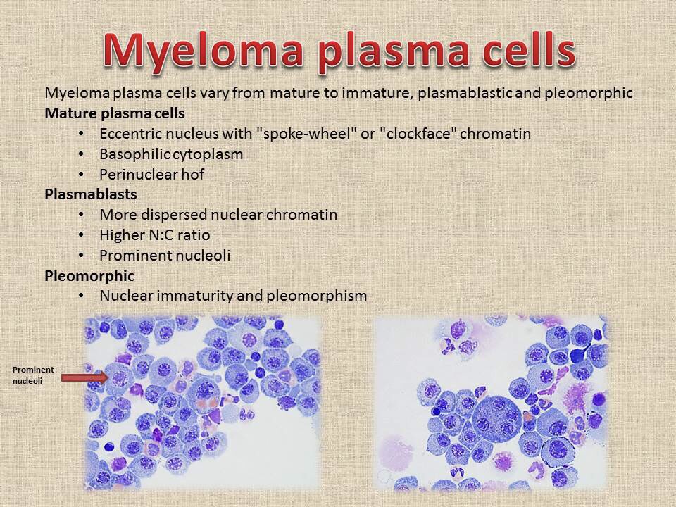 Plasma Cell Clock Face Dividing Plasma Cells In The Cerebrospinal