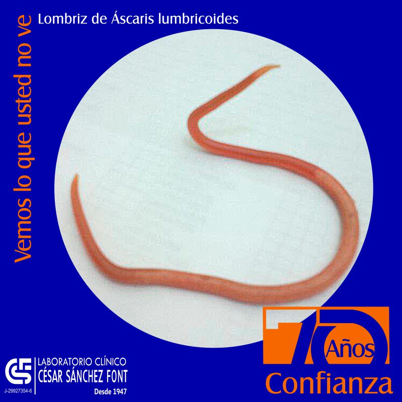 Lombriz Intestinal