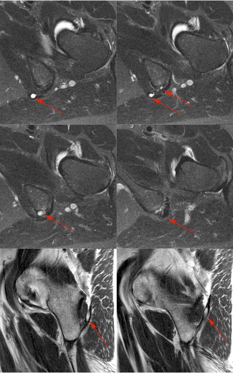 Anatomy Mri Msk at Nina Pierson blog