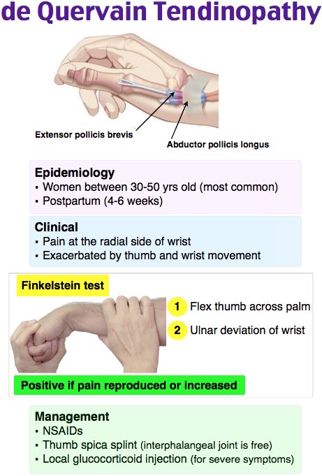 Abductor Pollicis Brevis Test