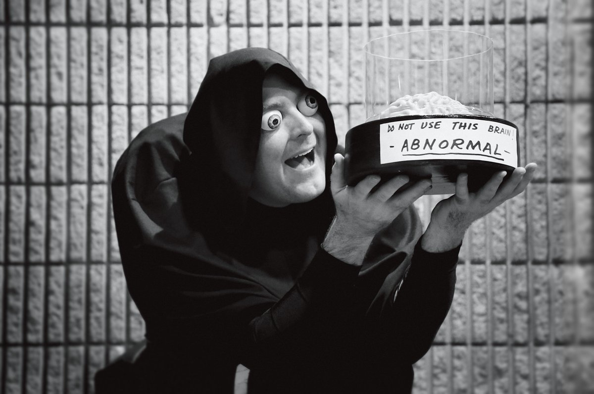 Young Frankenstein Igor Brain