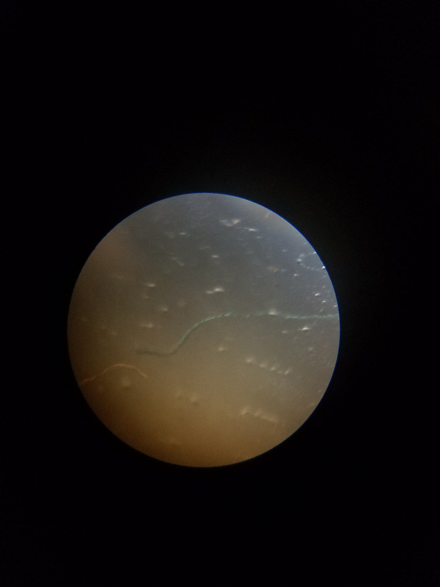 Strawberry Dna Under Microscope