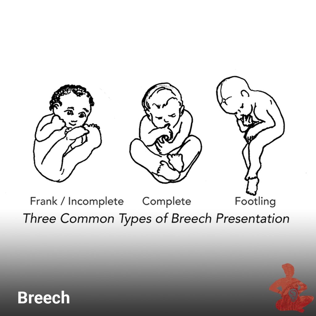 Breech Types
