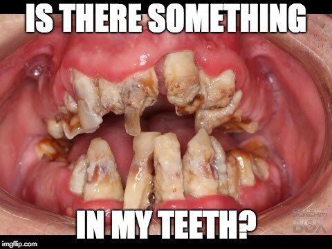 Gross Teeth Memes 20 Dentist Memes (Top Hilarious Dentist Memes)