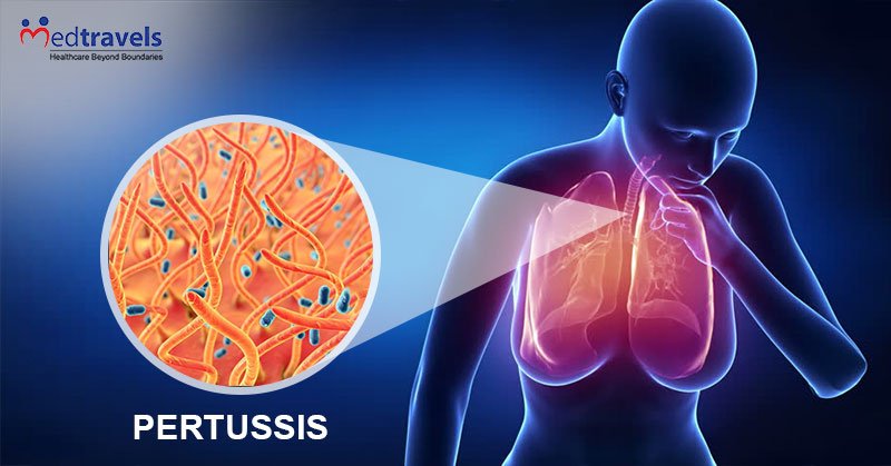Whooping Cough Lungs