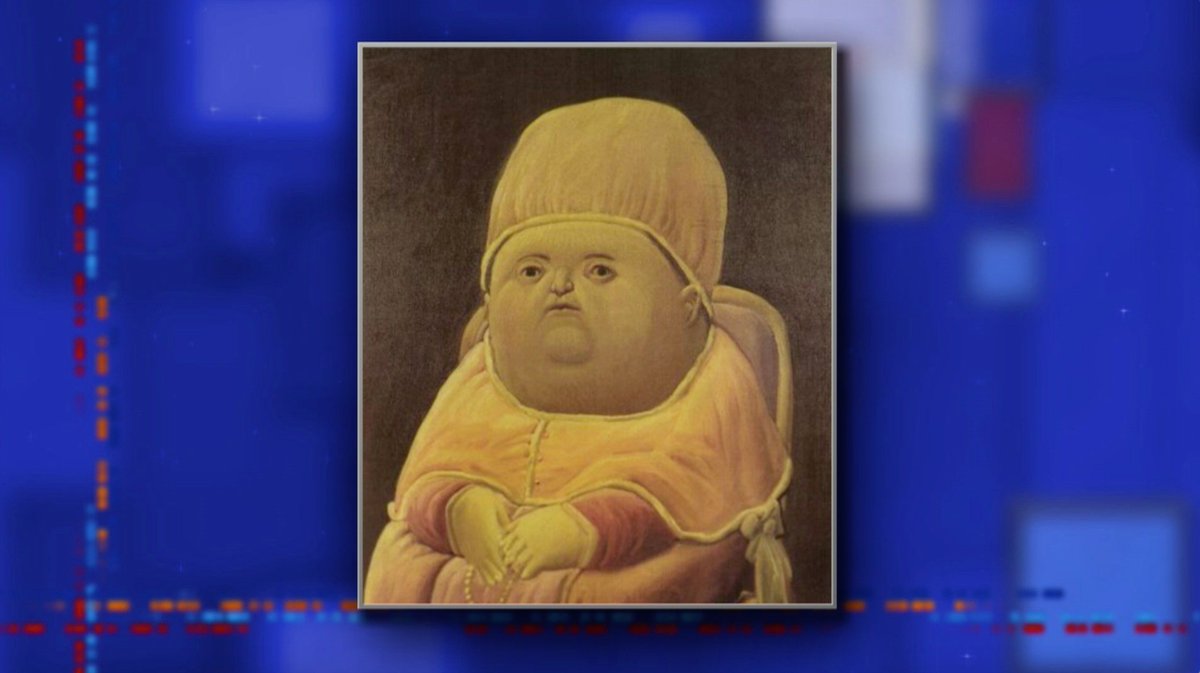 People Born Without A Neck