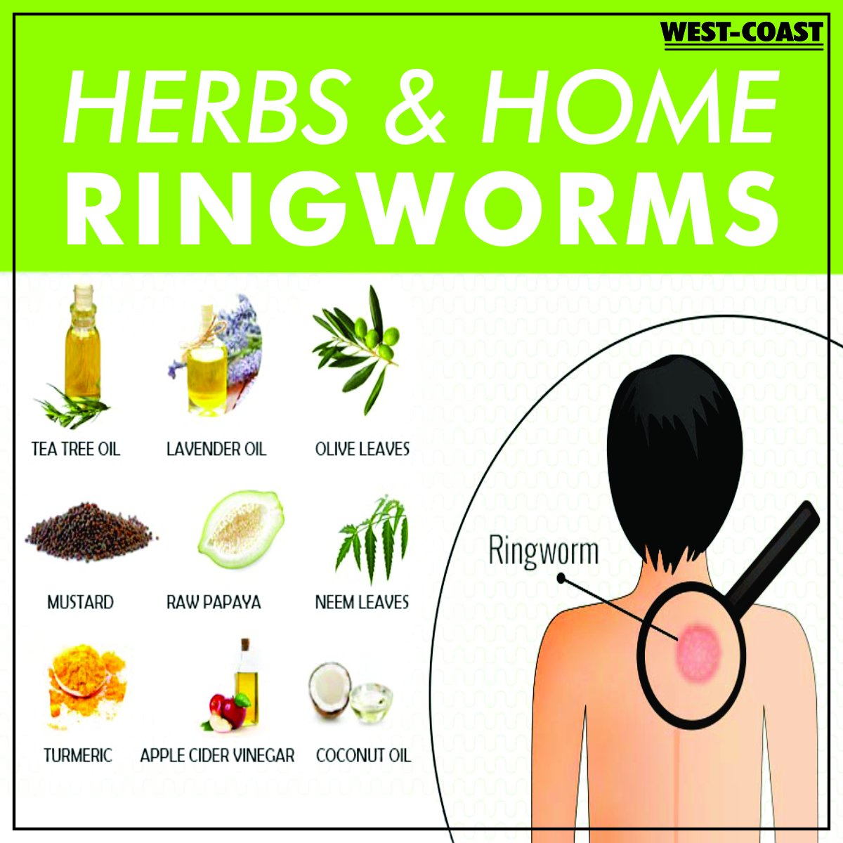 Ringworms On Humans Home Remedies