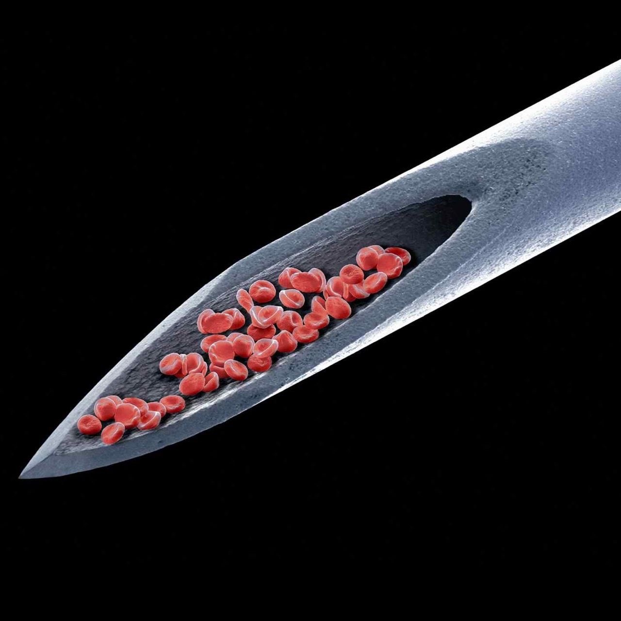 Red Blood Cell Electron Microscope