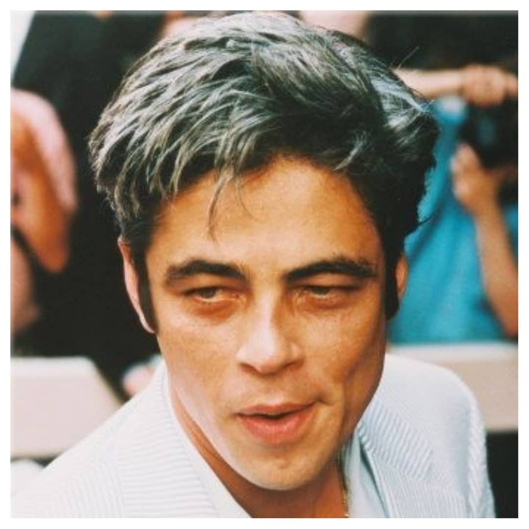 Celebrities With Dark Circles Under Eyes