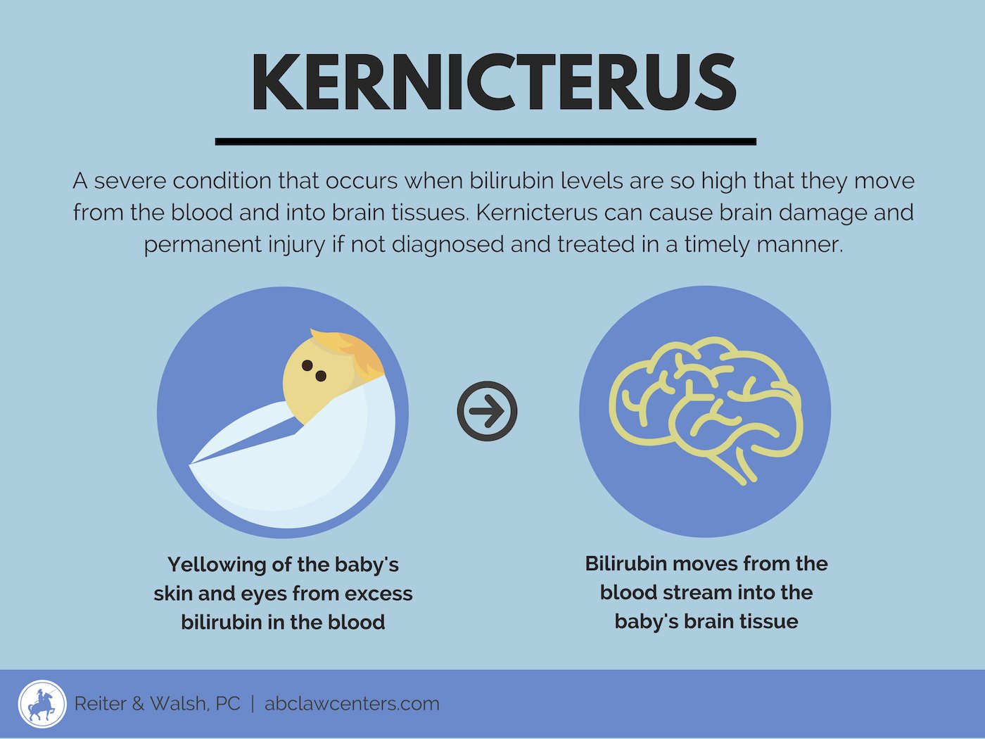 Kernicterus Eyes